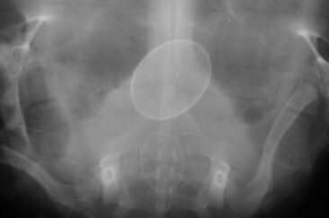 Caso clínico de radiografía, ecografía y endoscopia en tortuga